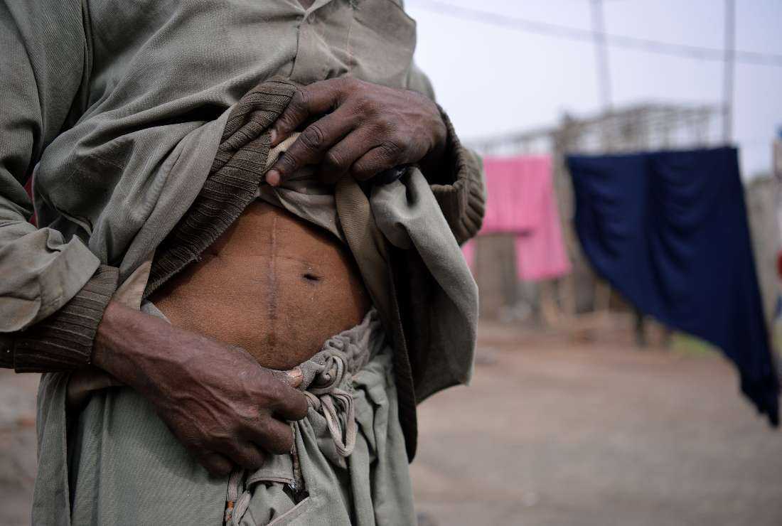 Pakistan police bust organ trafficking racket - UCA News